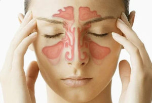 Burning sinuses store